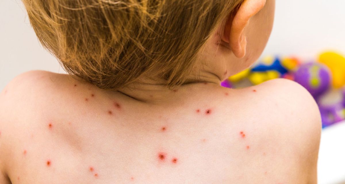 Rokko tarttuu helposti | Tehy-lehti